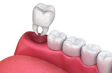 Smiles on 1st - Cosmetic Dentistry - Dr. Dagmar Colons DDS- Evansville, IN